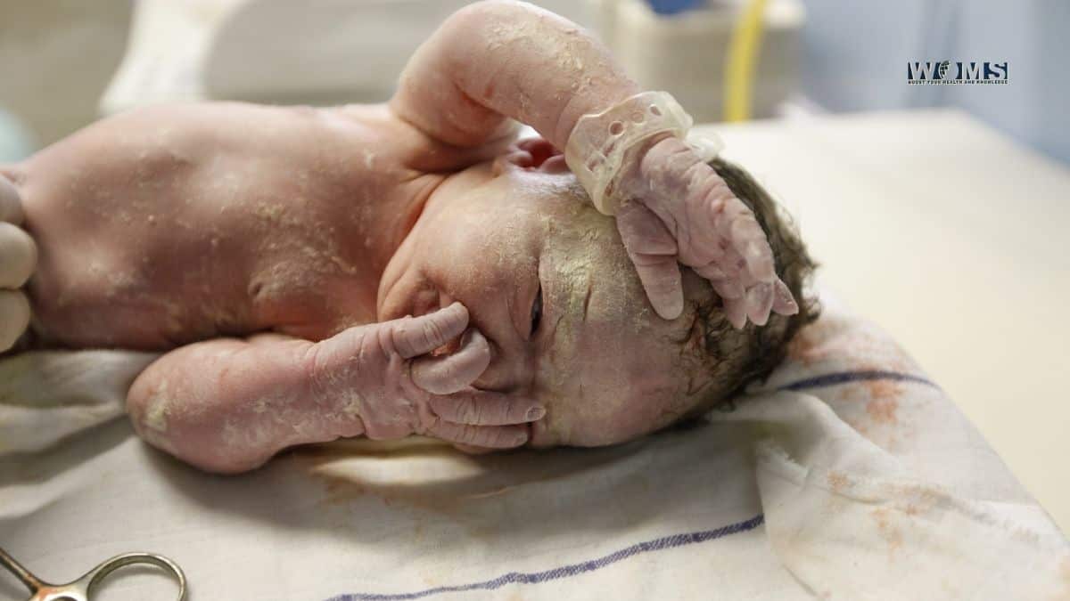 Vernix Caseosa: What is It? - Make My Health Well
